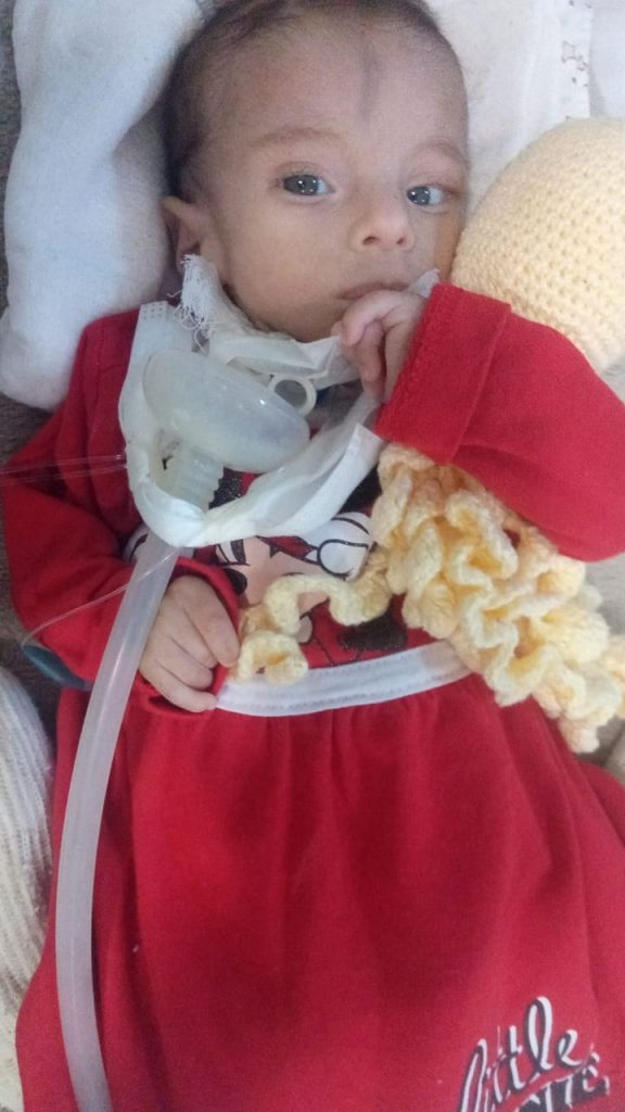 Família cria vaquinha pra bebê de Jacareí que sofreu queimaduras no ...